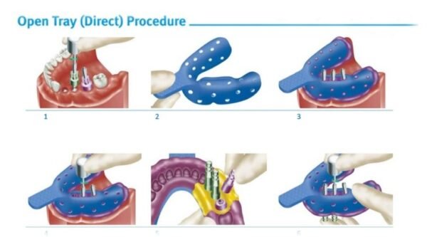 Edentulous patients article - Digital Dentistry Schoology