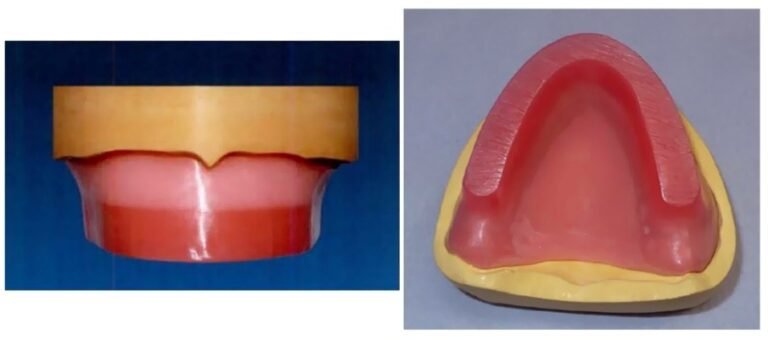 Overview of the Digital Trifunctional Intraoral Appliance for Centric ...