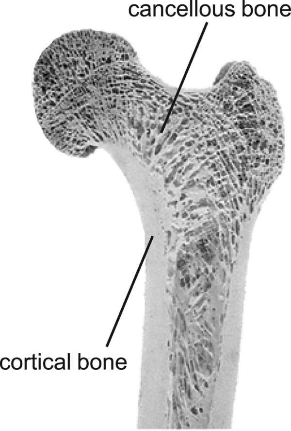 Bone Grafting Materials: Comparative Analysis - Digital Dentistry Schoology