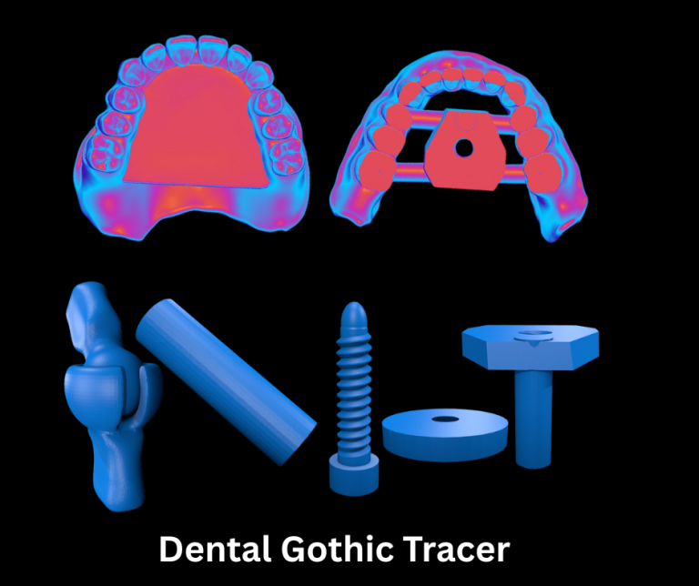 Dental Gothic Arch Tracer STL File – 3D Printable Gothic Arch Tracing ...